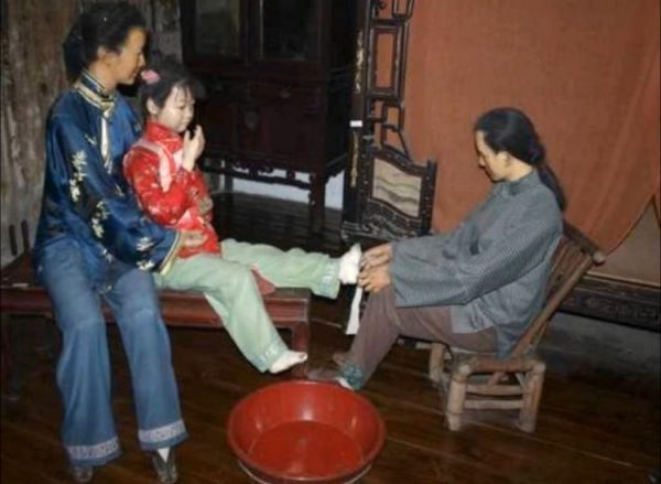 Foot Binding and Health Consequences - Nspirement