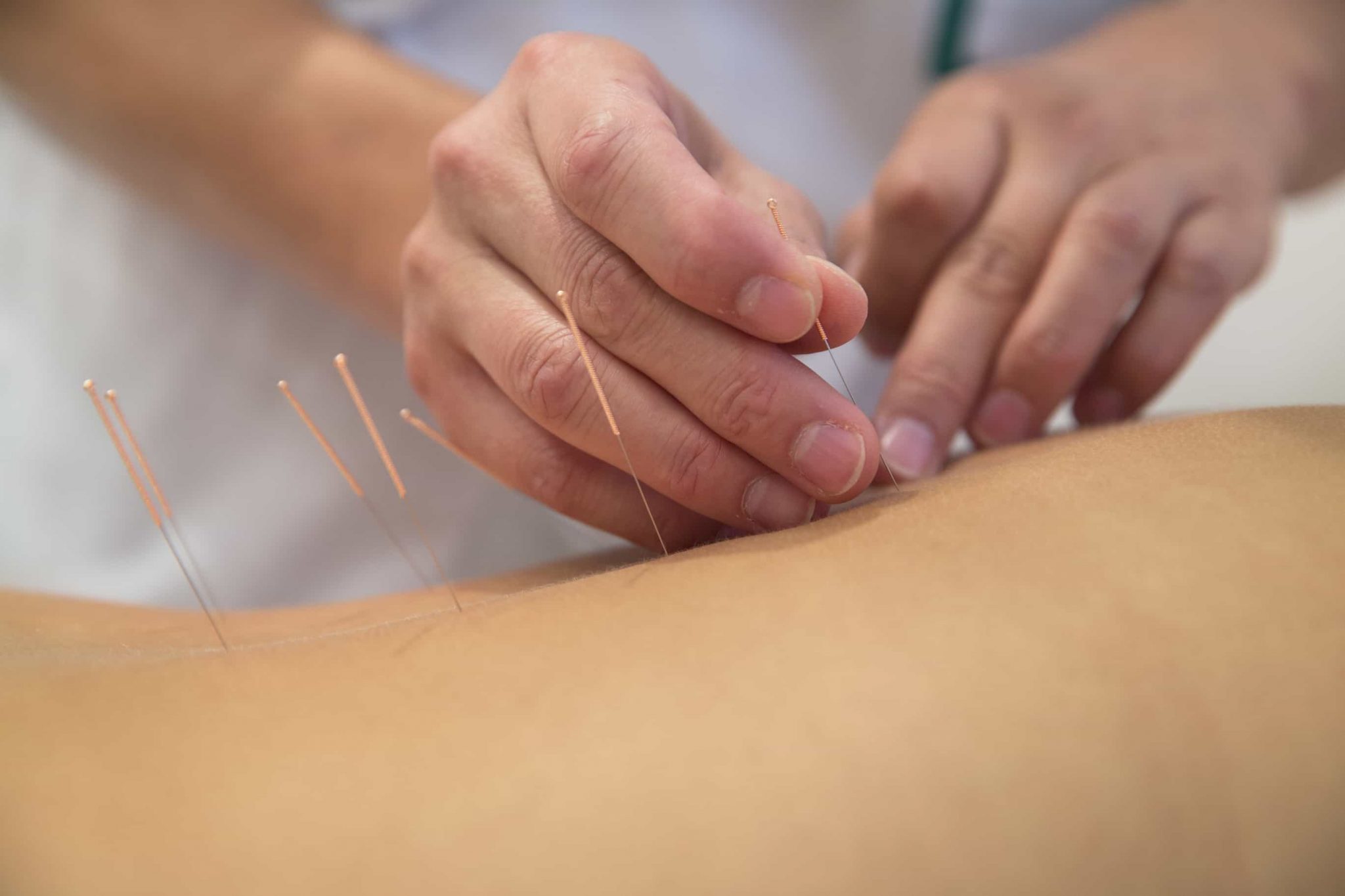 The Healing Power of TCM (Traditional Chinese Medicine): A Modern ...